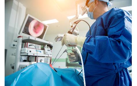 7 Hal yang Perlu Diketahui tentang Proses Endoskopi - Endoskopi