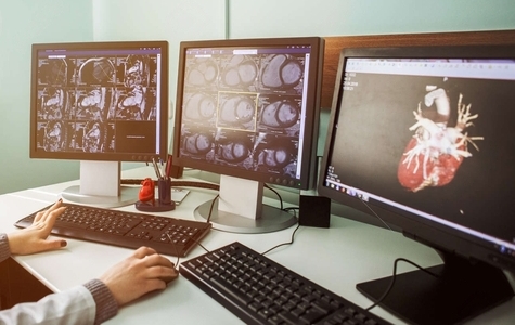 CT Scan Jantung: Fungsi, Prosedur, dan Efek Samping