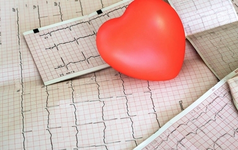 6 Pemeriksaan Skrining Jantung yang Mungkin Direkomendasikan Dokter