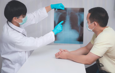 Mengenal Prosedur Transbronchial Lung Biopsy, untuk Memeriksa Paru